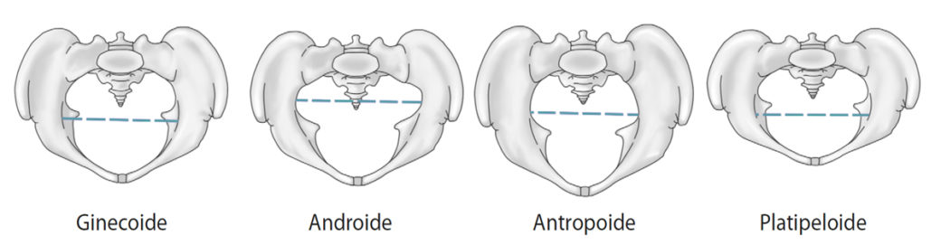 Tipos de pelve – Anatomia papel e caneta